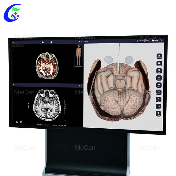 3D Virtual Dissection Anatomy Table | MeCan Medical